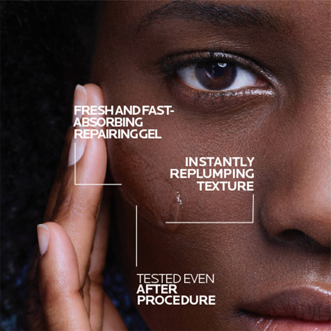 What is Madecassoside & Benefits | La Roche-Posay Australia