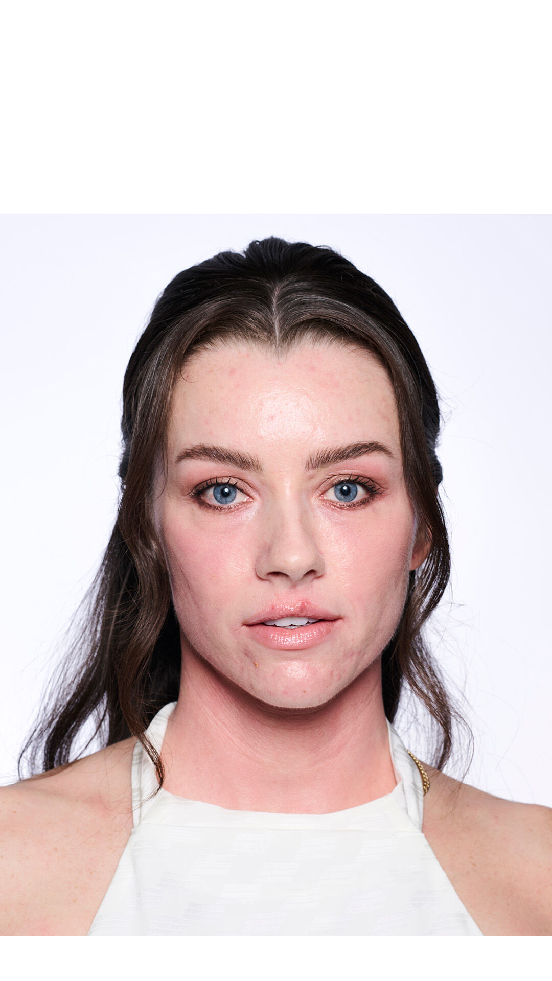 We Stand For Skin Life Changers | La Roche-Posay® Australia