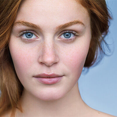 blushing red face causes